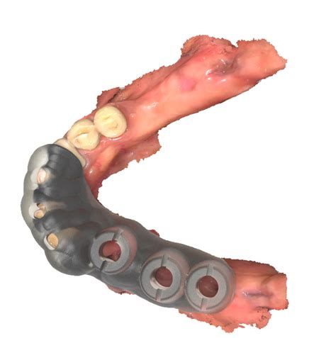 Steiners Analysis Free Online Cephalometry Dental Orb