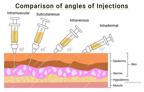 Premium Vector Injection Syringe On The Skin Layers Types And Comparison Of Injections