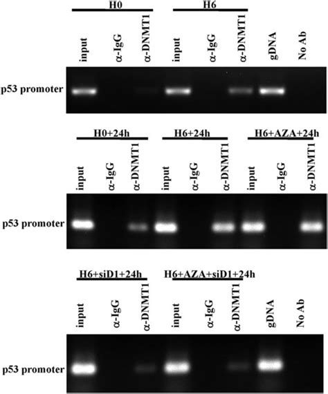 Dnmt1 Represses P53 By Binding To Its Promoter Locus Chip Assay Was