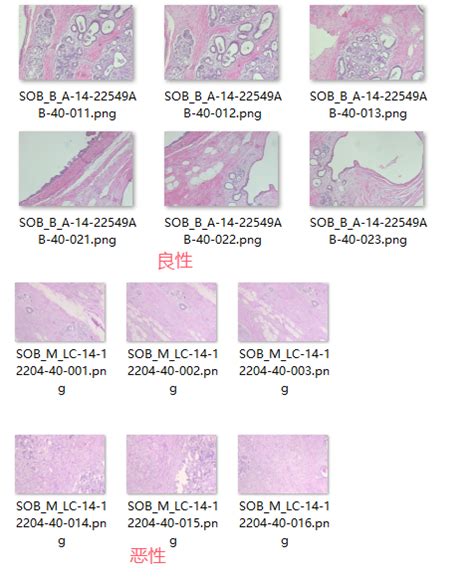 多示例学习模型的力量：深度解析病理图像分类的ai实现 多实例学习 病理图像是什么意思 csdn博客