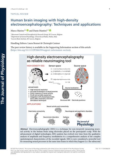Pdf Human Brain Imaging With High‐density Electroencephalography Techniques And Applications