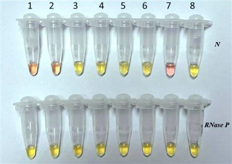Color Visualization Of Rt Lamp Assay Pink Indicates Negative Yellow