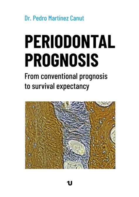 Periodontal Prognosis From Conventional Prognosis To Survival Expectancy 9788419668219