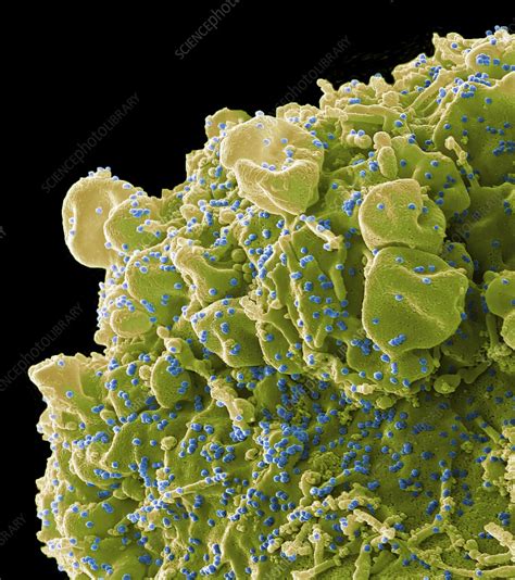Sars Cov 2 Omicron Variant Sem Stock Image C057 2991 Science