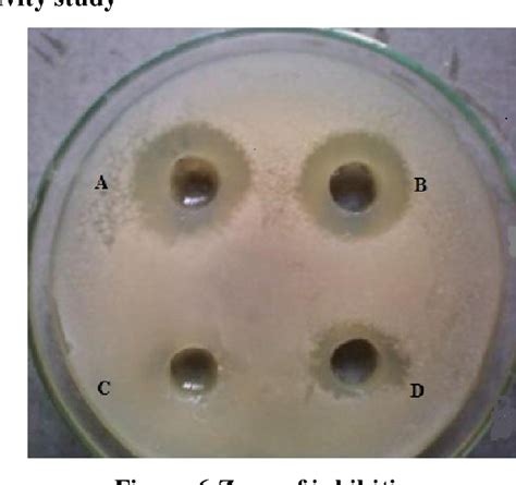 Figure 6 From Development And Evaluation Of Microemulsion Based Hydrogel Of Econazole Nitrate