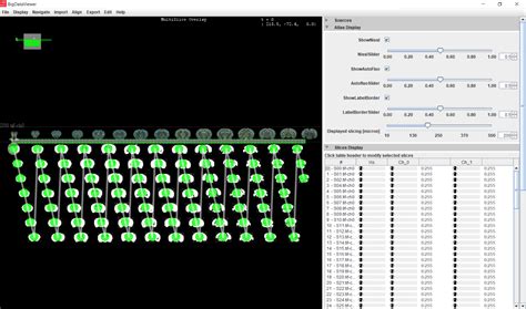 Fiji Bdv Navigation And Qupath Project Import — Abba Documentation 0