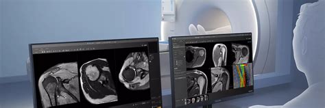 Mr Smart Workflow Philips