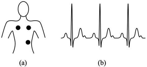 Electrocardiogram Ecg Based User Authentication Using Deep Learning Algorithms Pmc