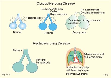 Lung Dz Respiratory Diseases Lung Disease Physiology