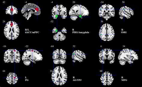 brain regions showing positive red and negative green correlation download scientific