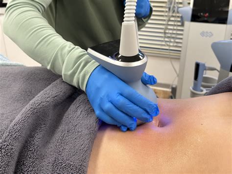 Revolutionising Body Sculpting The Exion Machine Younique Aesthetics