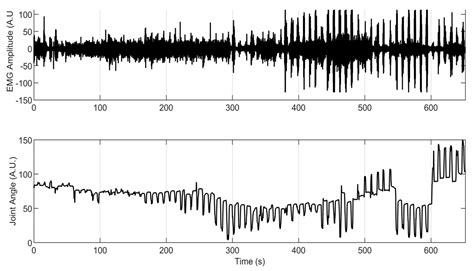 A Multi Dof Prosthetic Hand Finger Joint Controller For Wearable Semg Sensors By Nonlinear