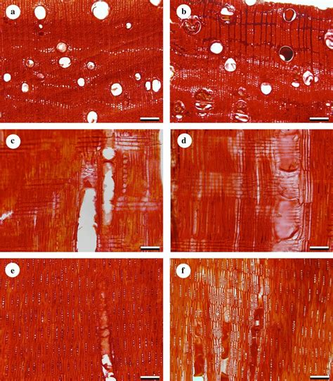 Light Micrographs Of Transverse Radial And Tangential Sections Of