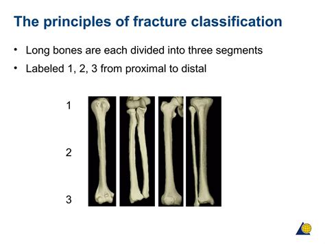 Ao Classification Ppt