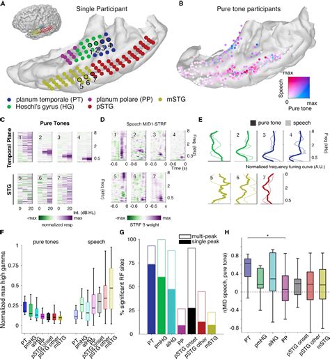 figure 1 from parallel and distributed encoding of speech across human