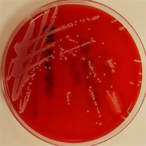 Pdf Isolation And Characterization Of Staphylococcus Aureus In