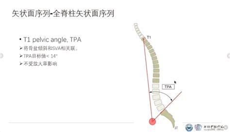 王凯教授：脊柱的矢状位和冠状位平衡 脑医汇