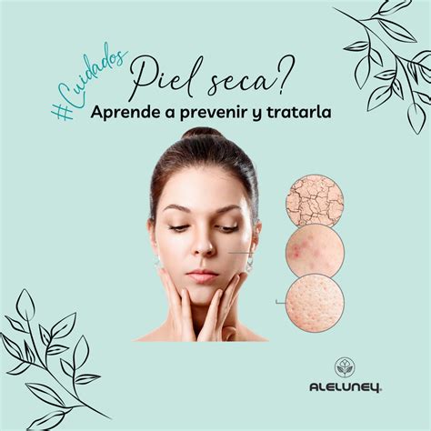 ¿por Qué Tengo La Piel Seca Descubre Aquí Las Principales Causas