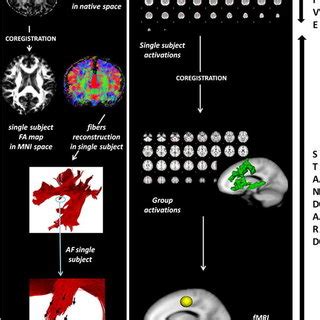 Integration Of Diffusion Tensor Imaging DTI And Functional Magnetic Download Scientific