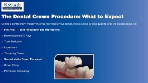 Ppt Crowning Glory Everything You Need To Know About Dental Crowns
