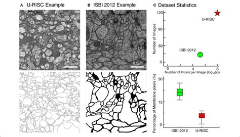 comparison between u risc and isbi 2012 a b an example of u risc