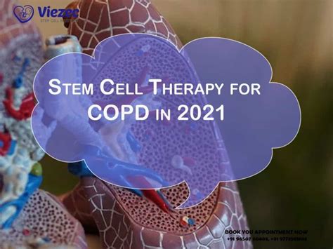 Stem Cell Therapy For Copd In 2021