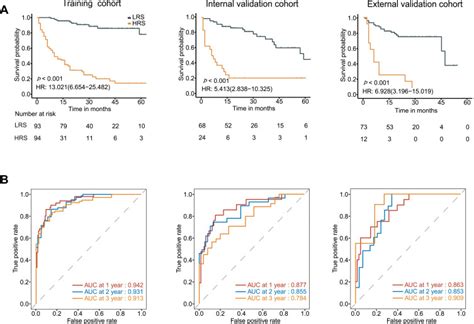 Ct Based Radiomics For The Recurrence Prediction Of Hepatocellular Carcinoma After Surgical