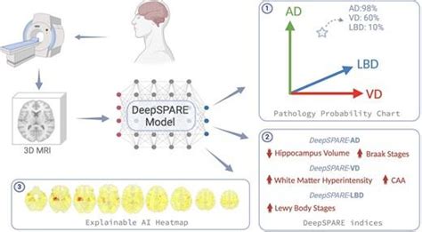 Deep Learning Reveals Pathology Confirmed Neuroimaging Signatures In