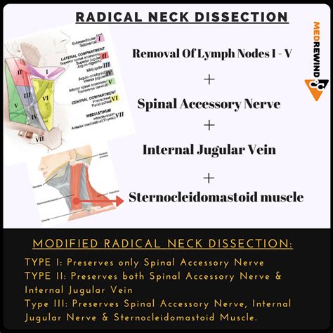 Radical Neck Dissection