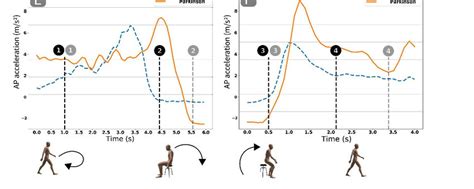 Graphical Presentation Of The Postural Control Gait Turn To Sit And Download Scientific