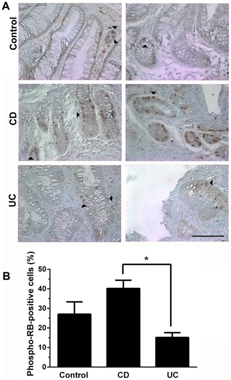 A Rb Phosphorylation Was Detected In Colon Biopsies From Control Non
