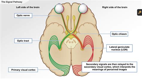 Understanding The Anatomy Of The Visual System A D A M OnDemand