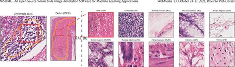 figure 2 from wsi2ml an open source whole slide image annotation