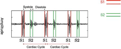Figure 1 From A Noise Robust Heart Sound Segmentation Algorithm Based On Shannon Energy