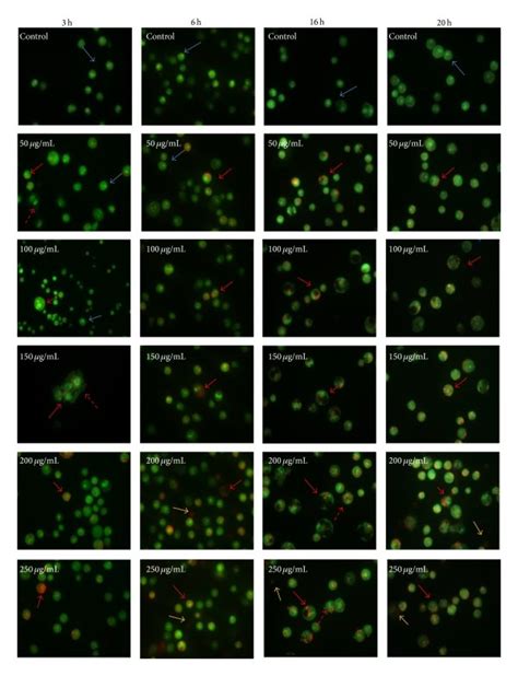 Acridine Orange Ethidium Bromide Staining Was Carried Out To Reveal Download Scientific Diagram