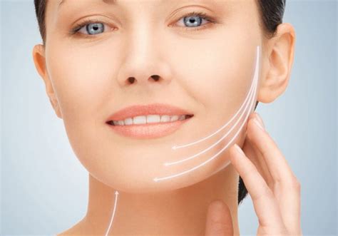 Ppdo Thread Lift For Facial Contouring Pinnacle Figure