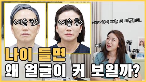 나이가 들면 왜 얼굴이 커 보일까 이유와 해결법 알려드릴께요 Feat 얼굴 커졌다고 무조건 지방분해주사등으로 깎는 행위는 비추 Youtube