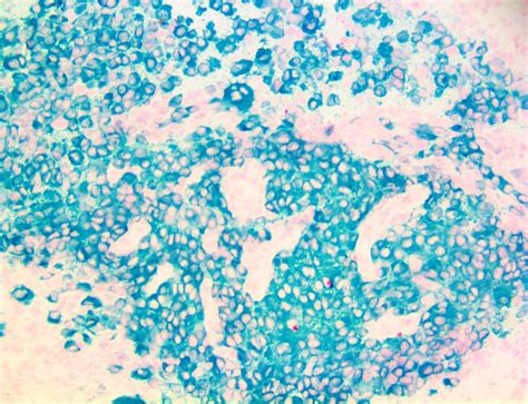 Mohs Polydetector Hrp Green Ihc Detection System Bio Sb