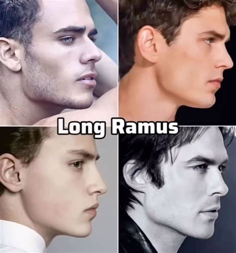 Best 13 What Is A Horizontally Developed Face And How To Measure It