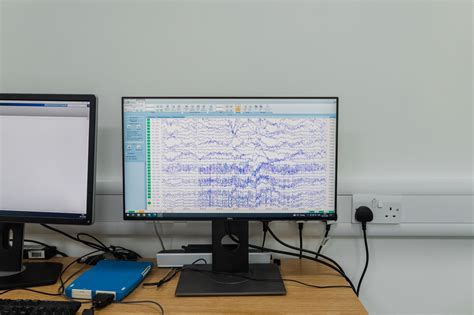 Eeg Output 4 School Of Psychology