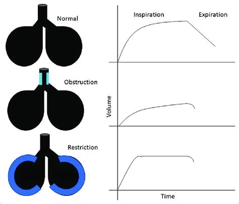 The Effect Of Obstruction And Restriction On The Breath And Time