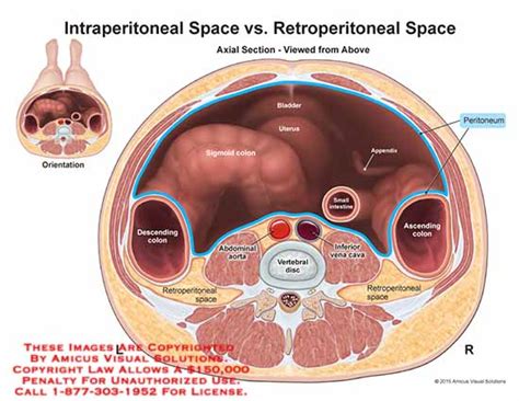 Anatomy Exhibits Page 38 Demonstrative Medical Illustrations