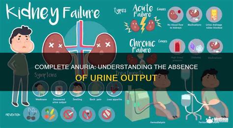 Complete Anuria Understanding The Absence Of Urine Output Medshun