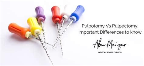 Difference Between Pulpotomy And Pulpectomy Your Full Guide