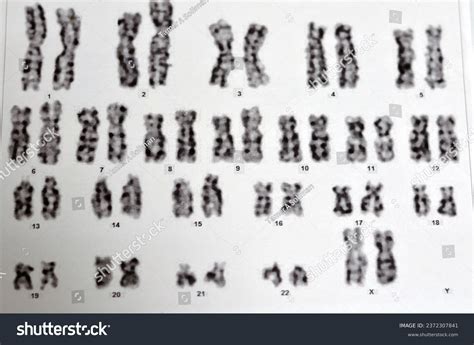 Karyotype Photos Images And Pictures