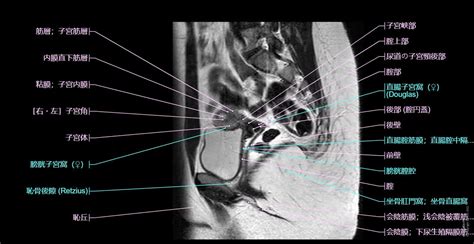 婦人科 Ct 正常解剖 Ct モダリティ 画像 Dmlbh