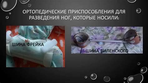 Гимнастика при Дисплазии тазобедренных суставов Youtube