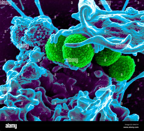 Staphylococcus Aureus Hi Res Stock Photography And Images Alamy