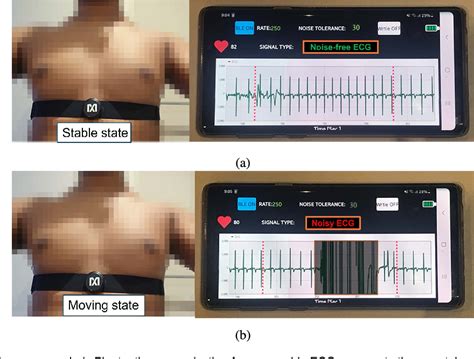Figure 1 From A Real Time Tunable Ecg Noise Aware System For Iot Enabled Devices Semantic Scholar