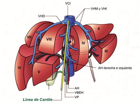 Cáncer De Hígado Y Segmentación Hepática De Couinaud Cáncer De Hígado